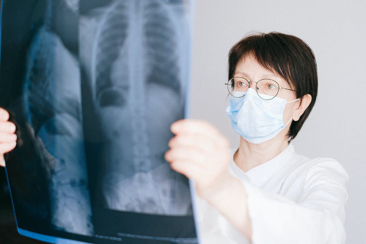 Get Your Facts Straight About Tuberculosis – Causes, Symptoms, and Ways ...